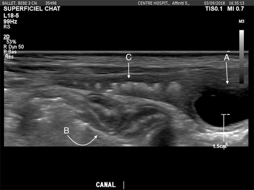 Persistance du canal de l'ouraque chez un chiot - CHV Saint-Martin